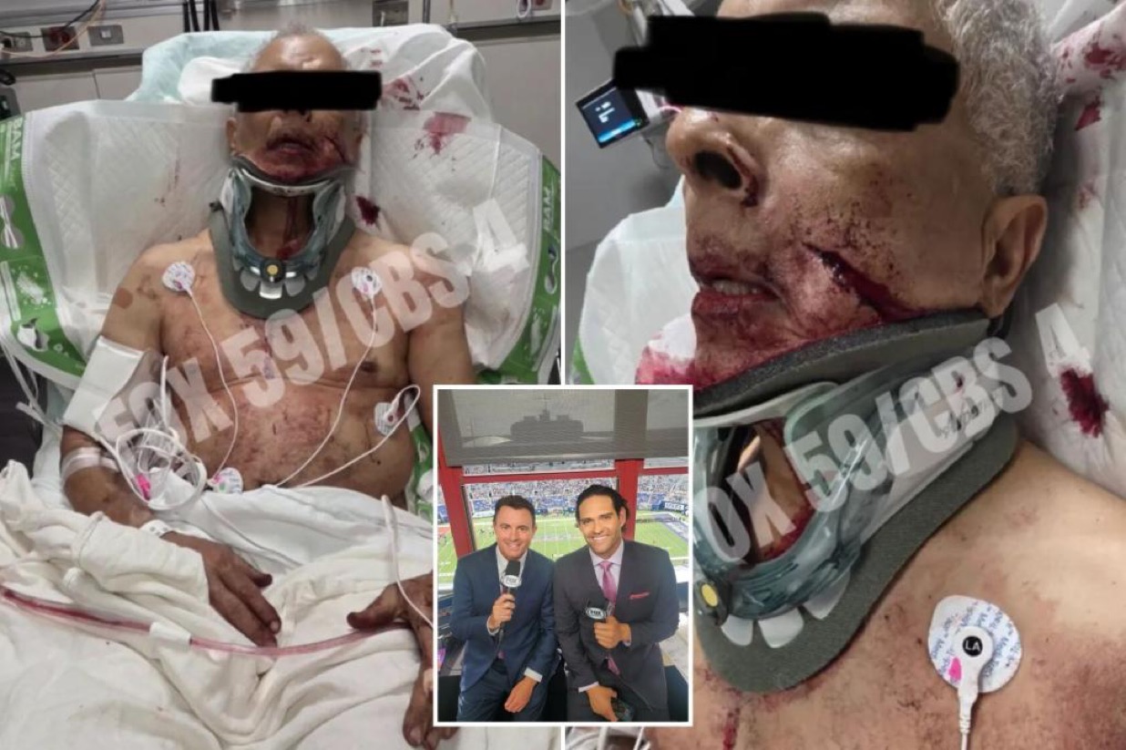 Truck Driver beat badly by Mark Sanchez before he stabbed QB